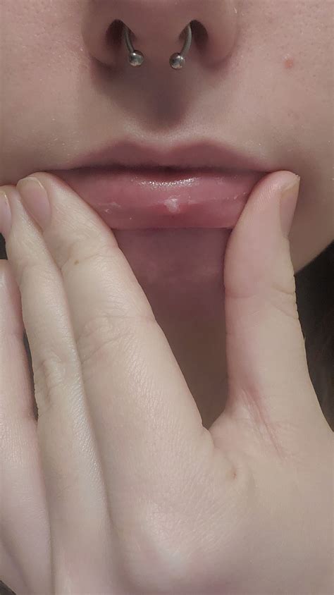 Vertical Labret Piercing Hole