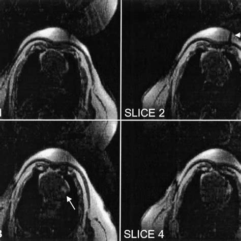 Configuration Of Mri System For Producing Real Time Volume Renderings