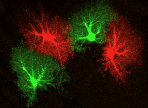 Experimental Nasal Drops Offer Hope Of Recovery For All Stroke Patients