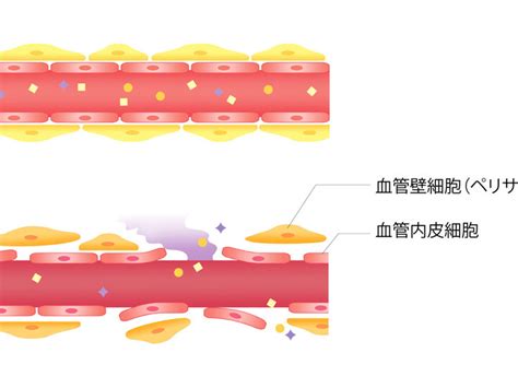 Covid 19とゴースト血管〜後編〜 Yokare