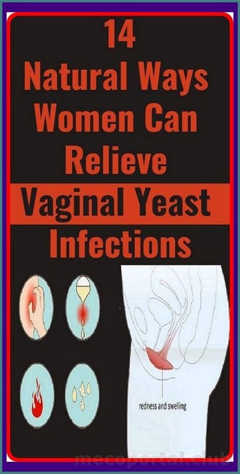 6 Steps To Treat Vaginal Yeast Infections Naturally Artofit