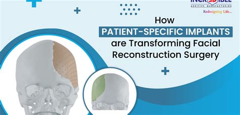 How Patient Specific Implants Transforming Facial Reconstruction