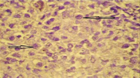 C Immunohistochemical Staining In Aml M1 Patient Technical Negative Download Scientific