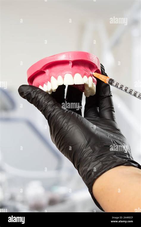 Dentist S Hand Holding A Layout Of The Human Jaw And A Syringe With
