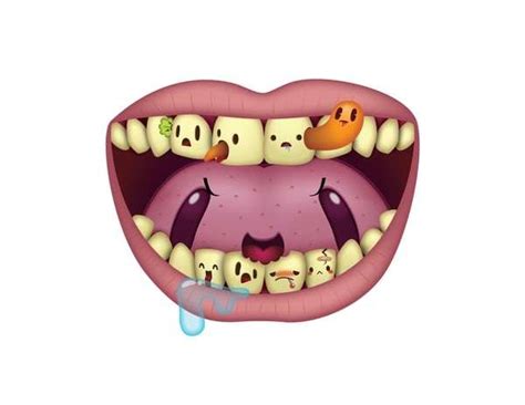 Front Tooth Decay Stop It Before Its Too Late