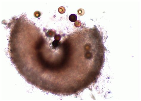 Hydroxy Proline And Gamma Aminobutyric Acid Markers Of Susceptibility