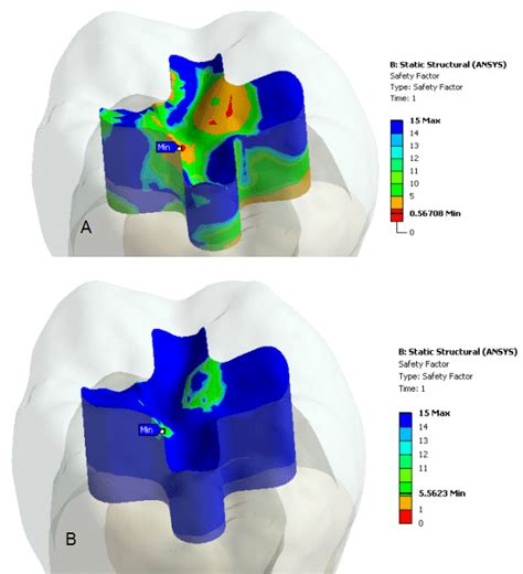Finite Element Method Investigation In ANSYS Software Of A Composite Download Scientific