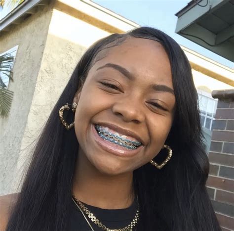 Pin On Braces Colors Straight Hairstyles Cute Braces Straight Human