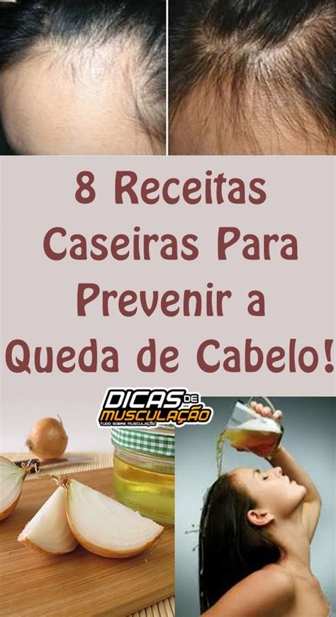As 10 Receitas Caseiras Para Tratar A Queda De Cabelo Salud