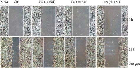 Triptonide Inhibits Human Cervical Cancer Cell Migration And Invasion
