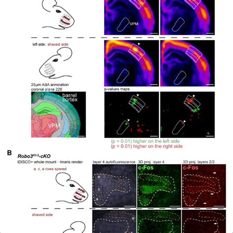 Structure Of The Vpm Maps Revealed By Infraorbital Nerve Ion Lesions