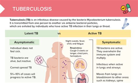 Tuberculosis Free Cheat Sheet Lecturio