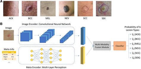 Skin Lesions Diagram