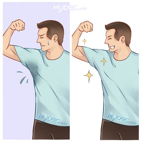 Best Body Odour Treatment Excessive Sweating Hyperhidrosis Treatment