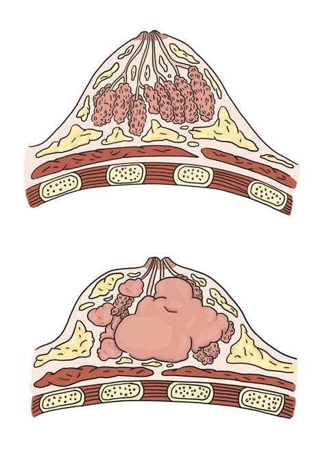 胸部摸起來有硬塊、胸部搔癢？《台灣女性乳癌白皮書》辨識常見乳房纖維囊腫，減少恐懼｜女人迷 Womany
