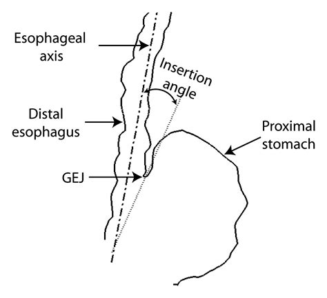 Gastroesophageal Junction Structure And Function As Assessed By Using
