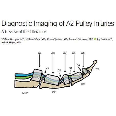 Diagnostic Imaging Of A2 Pulley Injuries Thomas Cunningham Md