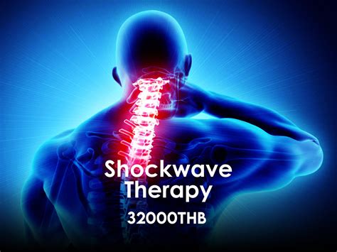 Focused Shockwave For Muscle Trigger Point Office Syndrome Plantar Fasciitis Back Pain