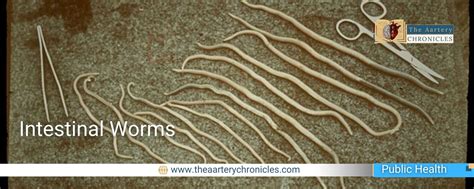 Intestinal Worms All That You Want To Know