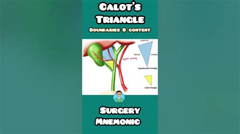 Calot S Triangle Boundaries And Content Youtube