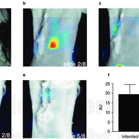 In Vivo Fluorescence Molecular Tomography FMT Of Cathepsin B
