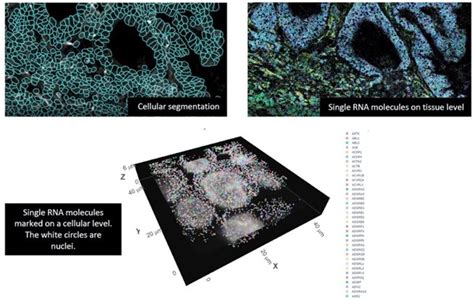 Nanostring Cosmx Spatial Molecular Imager Research At Umc Utrecht