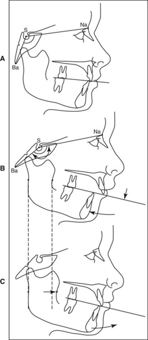 Growth And Development Pocket Dentistry
