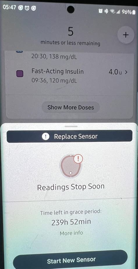 Huh I Guess I Cracked The Code R Dexcom