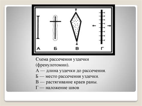 Пороки развития уздечек губ и языка мелкое предверие полости рта презентация онлайн