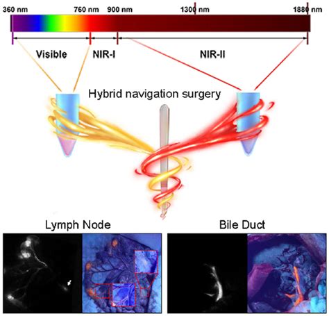 Nir Ii And Visible Fluorescence Hybrid Imaging Guided Surgery Via