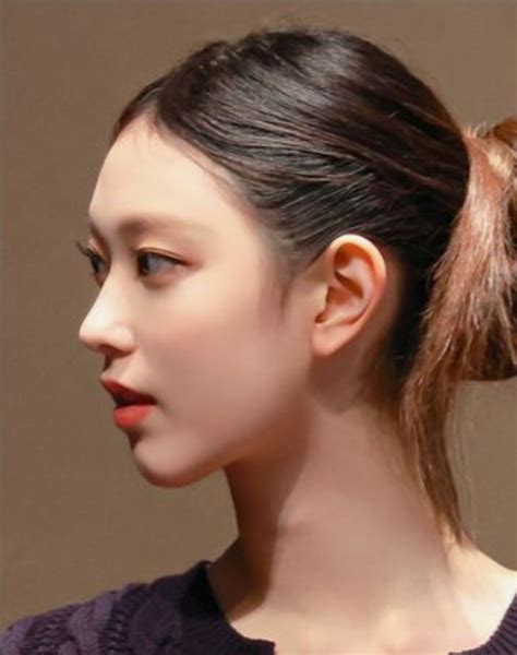 자유수다 해린이 코 존예인데 강남언니 1등 성형수술and피부시술 정보앱