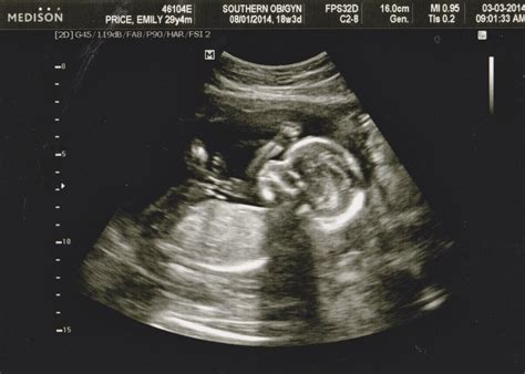 16 Weeks Pregnant Ultrasound Artofit