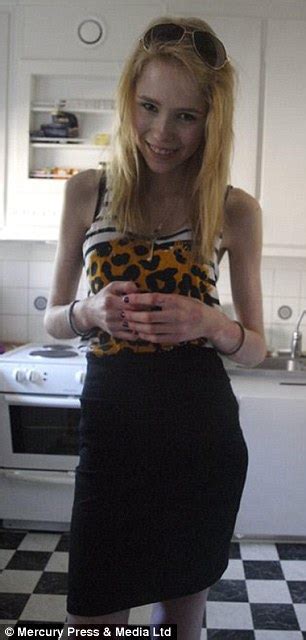 Teenager Overcomes Five Year Battle With Anorexia To Become A Runner