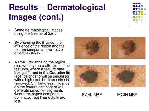Ppt Segmentation Of Dermatological Images Using Mixture Models And