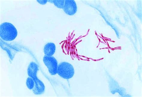认识结核分枝杆菌细胞壁世界菌落