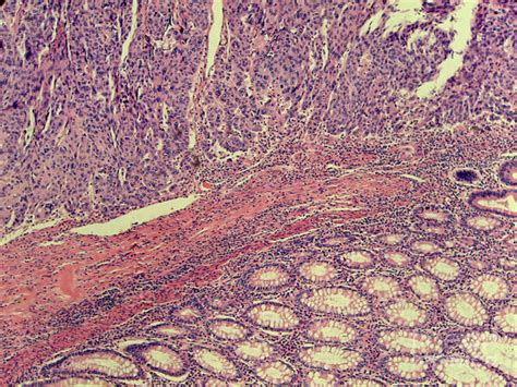 Gall Wall Art For Sale By Science Source Prints