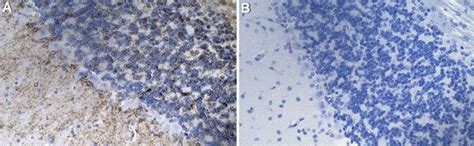 Anti Glucuronoxylomannangxm Antibody Clone 3e5 Mabf3125 25ug