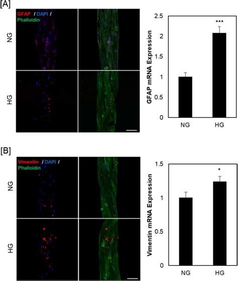 Glial Fibrillary Acidic Protein Gfap And Vimentin Expression Analysis