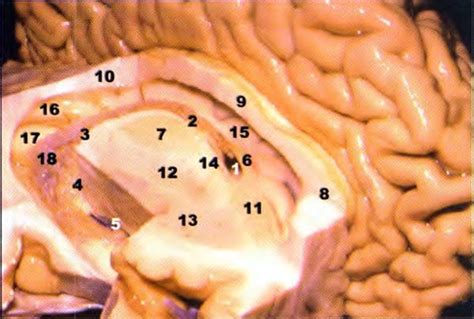 Pecten Del Pubis Un Vistazo Detallado Al Pecten Pubis E Anatomy Línea Pectínea Pubis