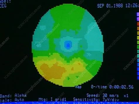 Eeg Brain Scan Results Warwick University 1994 Stock Video Clip K013 4823 Science Photo