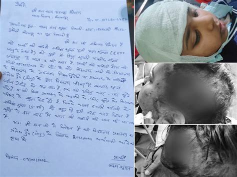 School Girl Attacked By 4 German Shepherd Dogs मिर्जापुर में जर्मन