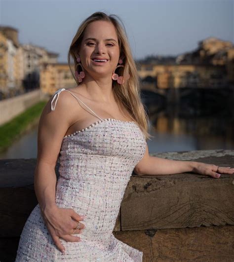 Victorias Secret Model And Partner With Down Syndrome Prove Love Knows No Boundaries Bright Side