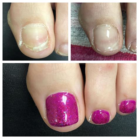 Even I Need Palmetto State Surgical Podiatry Associates