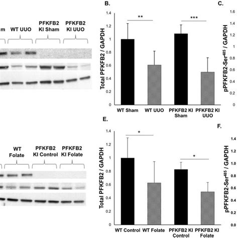 Pfkfb2 And Ppfkfb2 Expression In Wt Mice And Pfkfb2 Ki Mice With Uuo Download Scientific