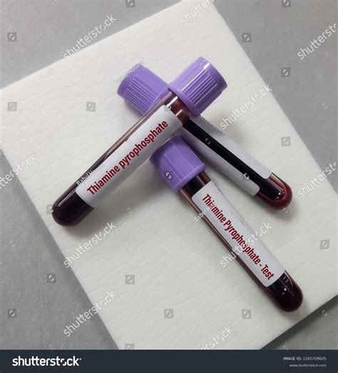 Thiamine Pyrophosphate
