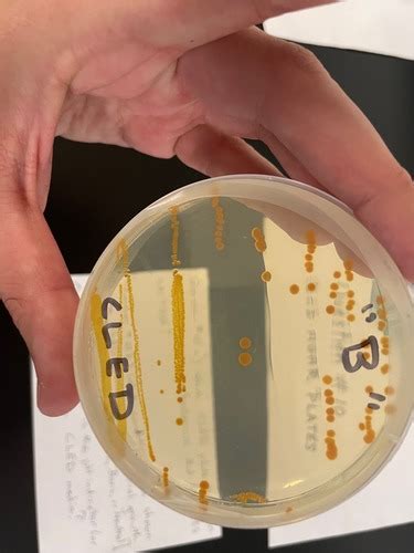 Lab Exam Flashcards Quizlet