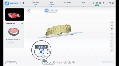 Full Denture Scan Workflow Of Desktop Scanner Adae Dental Online Store