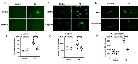 Downregulation Of Pkc δ And Sphk2 Or Inhibition Of Sphk2 Activity