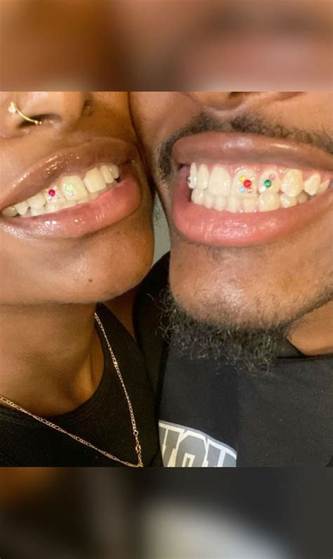 Grillz Aesthetic Grills Teeth Grillz Teeth Grillz