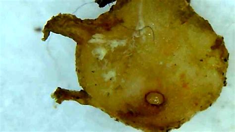 Dandelion Nodules And Nodule Cross Sections Under Magnification Free Photos On